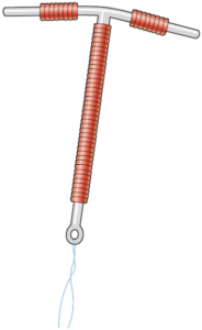 Intrauterine device (IUD) - Marie Stopes Kenya